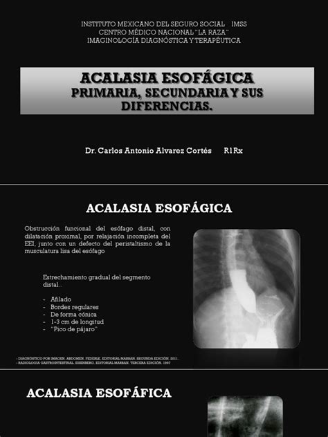 Acalasia Primaria Y Secundaria Pdf Enfermedades Digestivas Medicina
