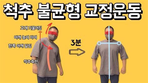 척추측만 어깨높이 고개기울어짐 한쪽라운드숄더 교정운동 Youtube