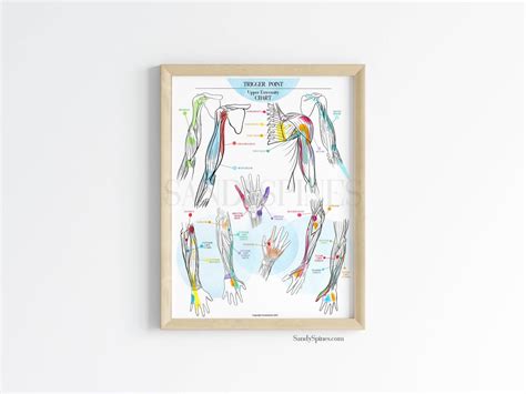 Trigger Point Upper Extremity Poster For Chiropractors And Pt Sandyspines