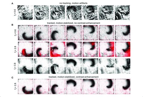 Efficacy Of Motion Compensation And Tracking Error Determined With Download Scientific
