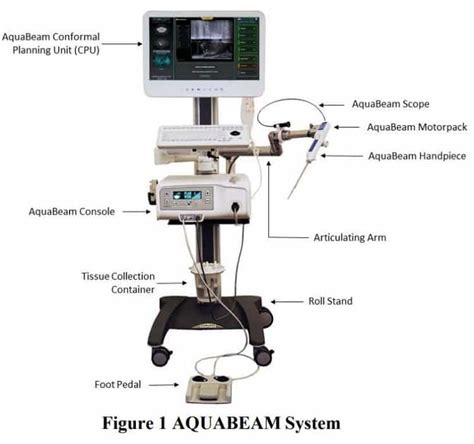 Procept Biorobotics Stock Surgical Robots For Urology Nanalyze