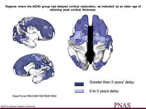 Brain Development Adhd Frontal Lobe Executive Functioning