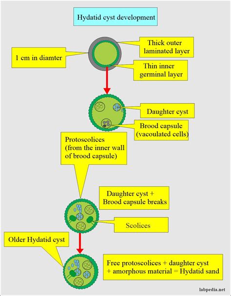 Echinococcus Granulosus Hydatid Cyst And Hydatid Disease