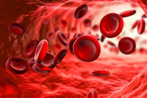 Cholesterol Emboli Md Searchlight