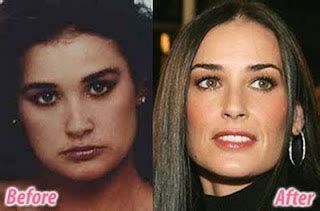 Demi Moore Before And After
