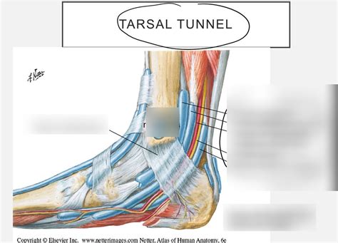 Tarsal Tunnel Diagram Quizlet