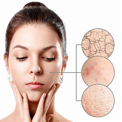 پوست صورت چرب بهتره یا خشک ؟ تفاوت‌ و راهکار مراقبتی روژاس