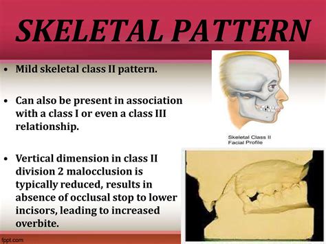 Class 2 Treatment In Growing And Adult Patients Pptx