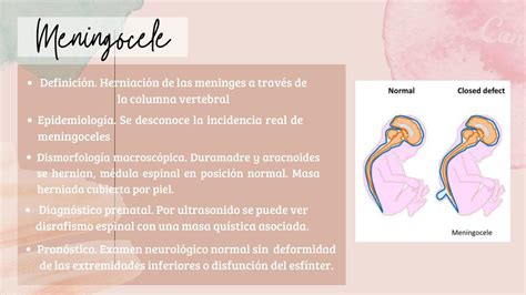 Resúmenes De Meningocele Descarga Apuntes De Meningocele