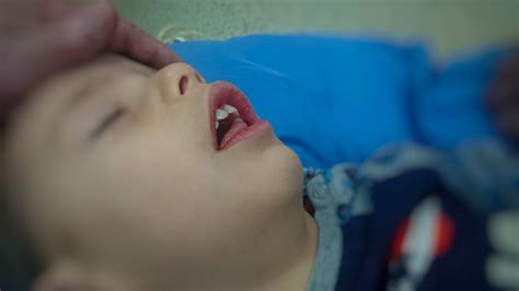 Трета сливица какво е общото между ортодонт и УНГ специалист Orthos Dent Care