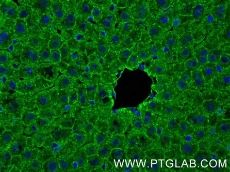 Adiponectin Receptor Antibody 85121 4 Pbs Proteintech