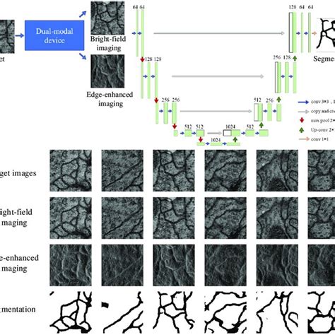 Single Pixel Segmentation Flowchart And Corresponding Results Download Scientific Diagram