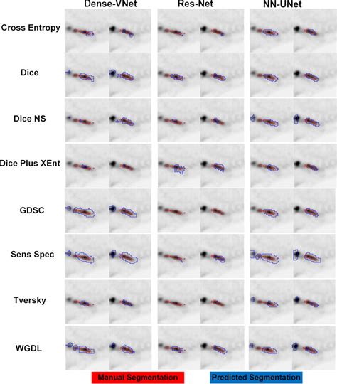 Two Dimensional Views Of Manual And Automated Segmentations Achieved By Download Scientific