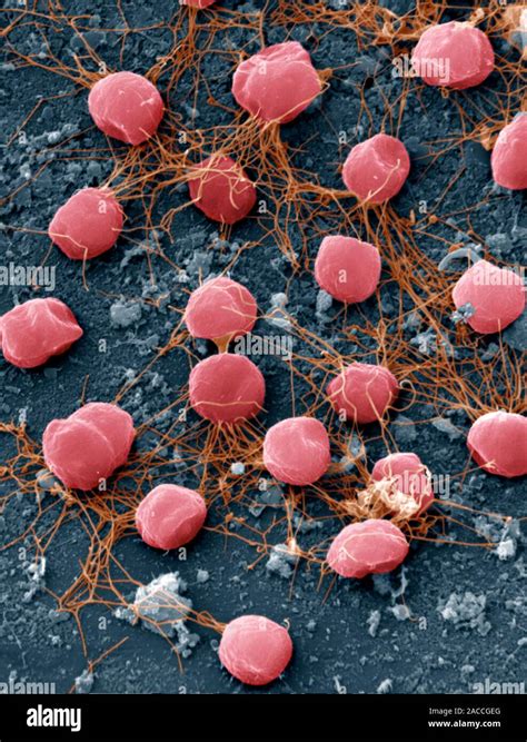 Pyrococcus Furiosus Archaea Coloured Scanning Electron Micrograph Sem Archaea Are Single