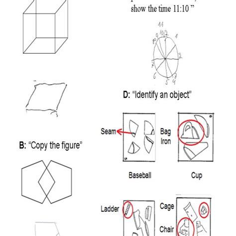 1 Visuo Spatial Assessment Of The Dlb Patients A B Necker Cube A
