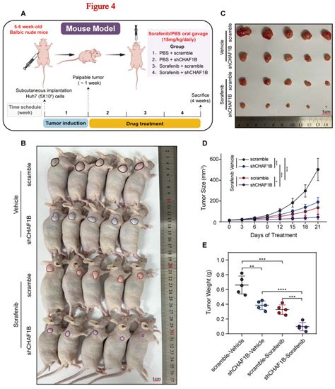 Chaf1b The Hidden Culprit Behind Sorafenib Resistance In