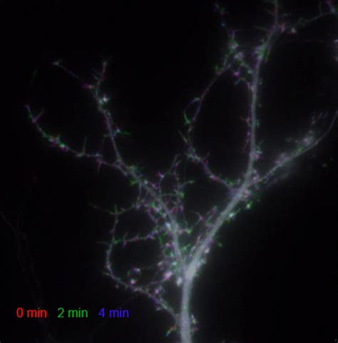 Dendritic Spines Are Dynamic Structures A Three Color Temporal Overlap