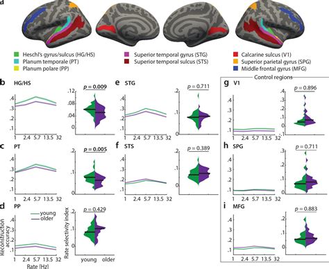 Temporal Selectivity Declines In The Aging Human Auditory Cortex Elife