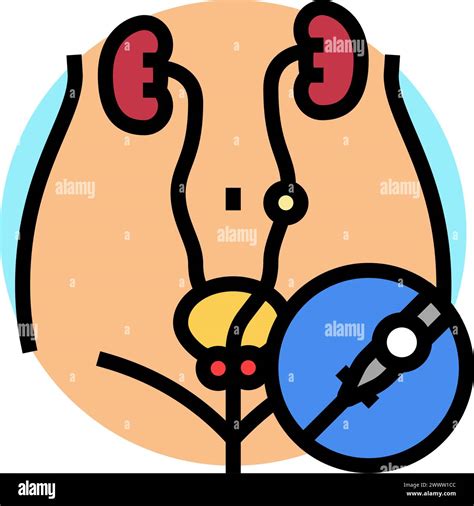 Ureteroscopy Urology Color Icon Vector Illustration Stock Vector Image And Art Alamy