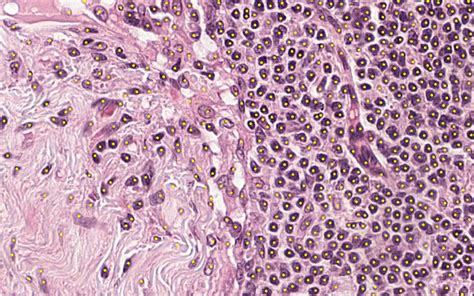 Asap Automated Slide Analysis Platform