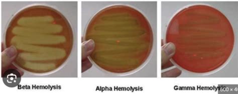 MIDTERM Lab Practical Flashcards Quizlet