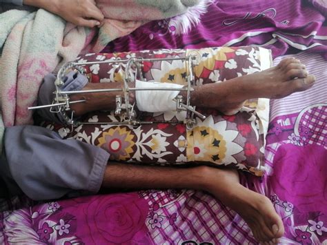 Waseem Hassan Khan On Linkedin Verifiedcase Help Money