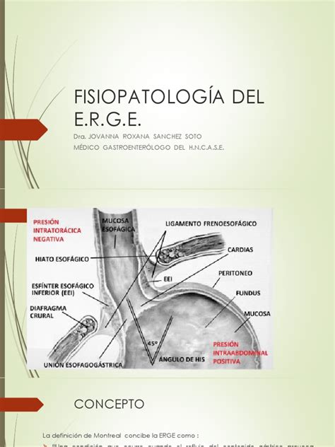 Fisiopatología Del Reflujo Gastroesofágico Pdf La Enfermedad Por