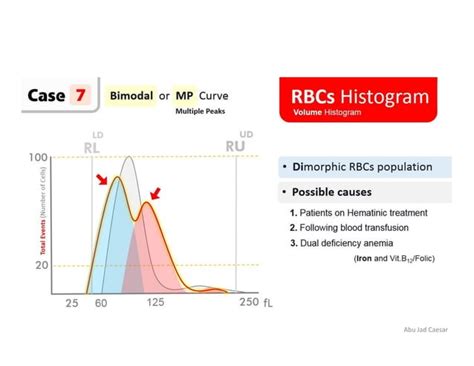 Rbc Histogram Ppt