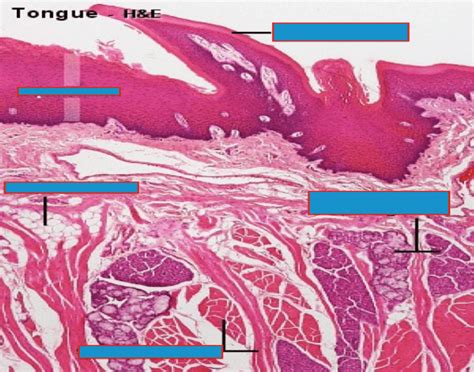 Tongue Histology Slide Labeled