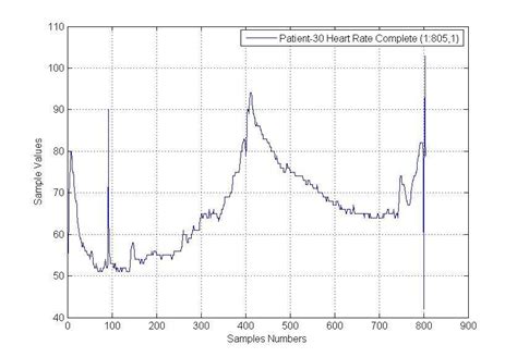 Waveform Signal Of Patient Using MATLAB Download Scientific Diagram