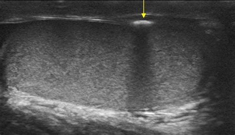 Urinary Tract And Male Reproductive System 2 3 Scrotum Case 2 3 1 Appendages And