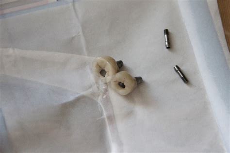 치과 임플란트 멸균 의료 용 봉투 치과 용 이중 치과 용 크라운 및 장착용 나사 한 쌍 건강관리와 의술에 대한 스톡 사진 및 기타 이미지 건강관리와 의술 관교의치