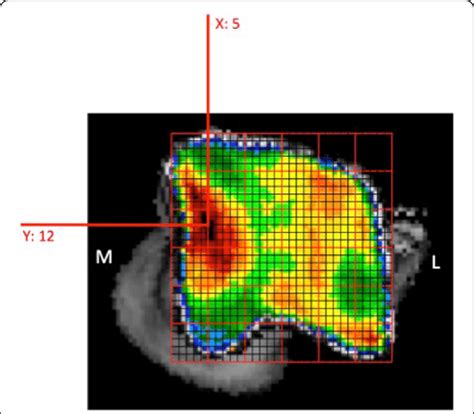 Positioning Of The Grid And Description Of The Subchondral Bone Density