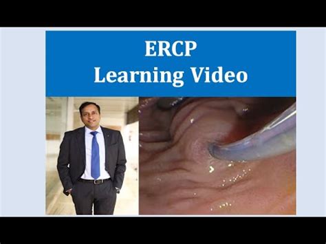 ERCP Learning Steps Cannulation Sphincterotomy And Stone Removal Dr Vikas Singla YouTube