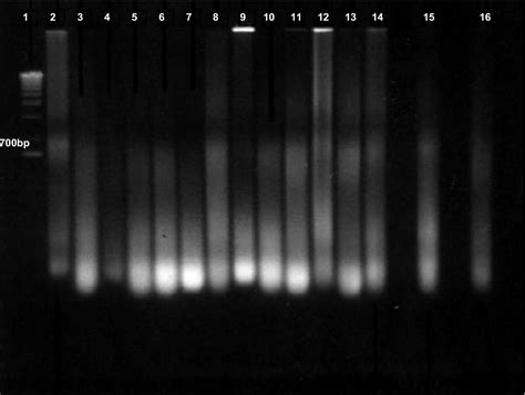 Figure 1 From Dna Extraction From Formalin Fixed Franciscana Tissues Semantic Scholar