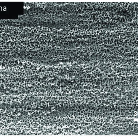 Nanotexture Of Titanium Alloy After Piranha Passivation Treatment