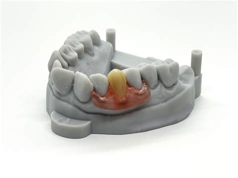 Flexible Nesbit To Finish With Model Gps Digital Rpd