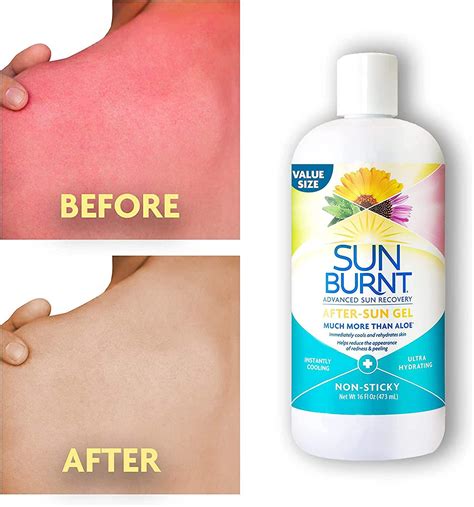 Sunburnt Ultra Hydrating Aloe Vera Gel Organic Blend For Soothing
