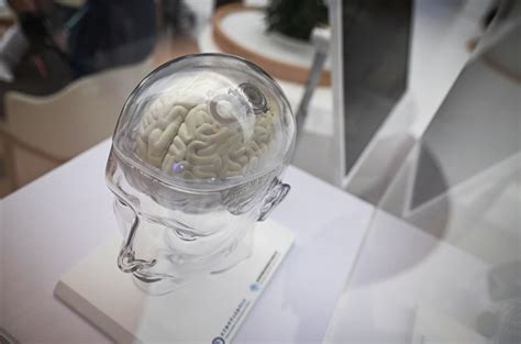 네이처 중국 마비 환자에게 더 많은 통제력을 부여하는 뇌 칩 개발에 돈 쏟아 중국에서 시험 중인 뇌 컴퓨터 인터페이스는