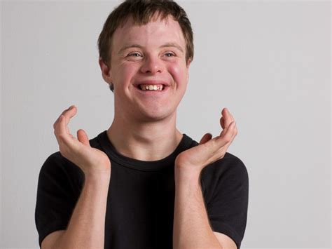 Down Syndrome Adults Equitable Access To Alzheimers Disease
