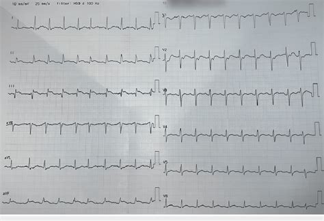 Initial Ecg Obtained Via A Secure Instant Messaging Communication Download Scientific Diagram