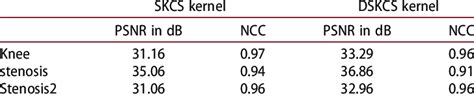 Comparison Of The Static And Dynamic Skcs Kernels Download Scientific Diagram