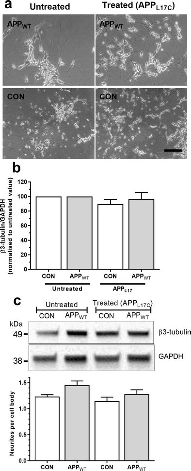 The Sh Sy5y Appwt Cell Line Morphology And β3 Tubulin Expression Were