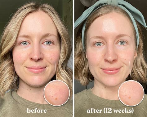 How To Use Red Light Therapy And Best Device • Organically Becca