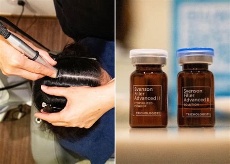 Svenson Hair Loss Treatment What Is The Most Effective Treatment For