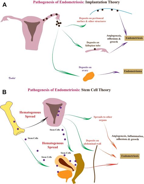Recent Advances In Pathogenesis Imaging Findings Classification