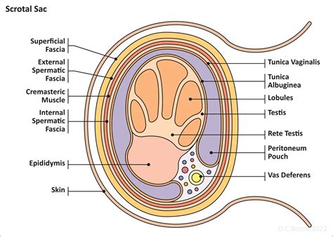Gamut Of Extratesticular Scrotal Masses Anatomic Approach To Sonographic Differential Diagnosis