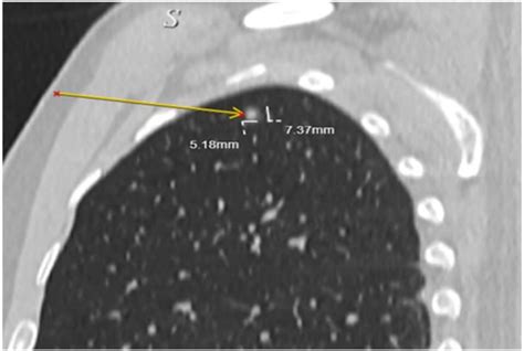 Ph T Hi N S M Ung Th Ph I