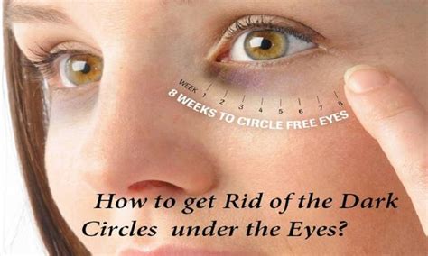 Easy Ways To Get Rid Of Dark Circles