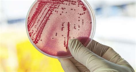 Bactéria Resistente A Antibióticos E Transmitida Sexualmente Assusta Especialistas Diário Da Manhã